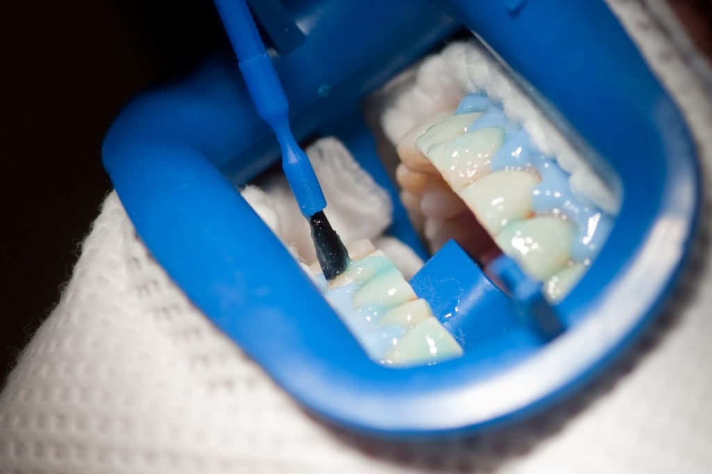 Bleaching-Produkte: Was macht die Zähne wieder weiß?