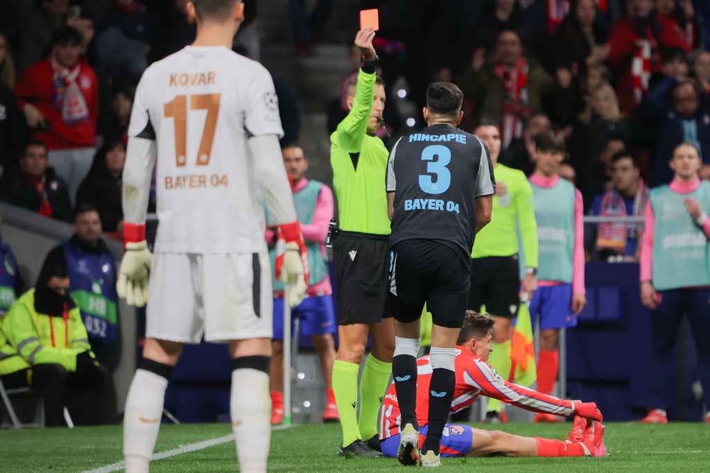 Alonso vermisst «Cool-Down-Mindset» bei Bayer-Pleite